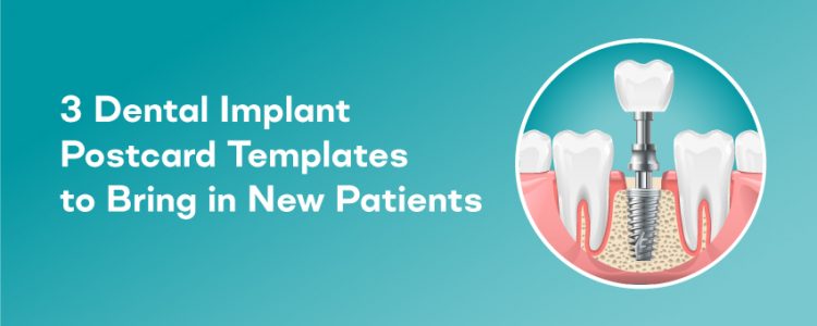 3 Dental Implant Postcard Templates to Bring in New Patients